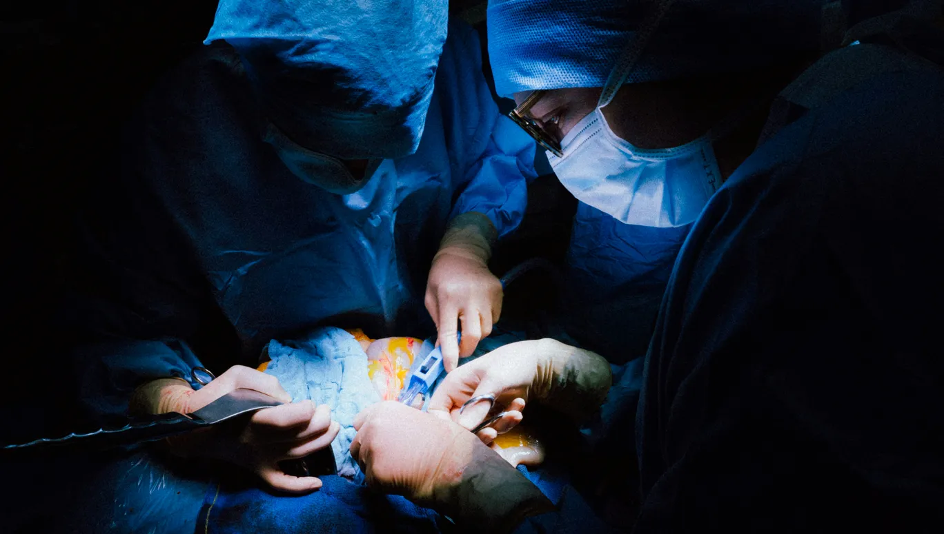 Amsterdam UMC becomes the first hospital in Europe to implant a double ...